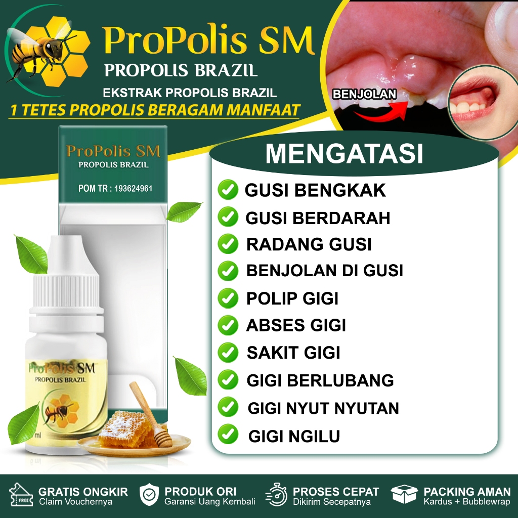 Jual Obat Gusi Bengkak Berdarah Bernanah Sakit Gigi Berlubang Benjolan ...