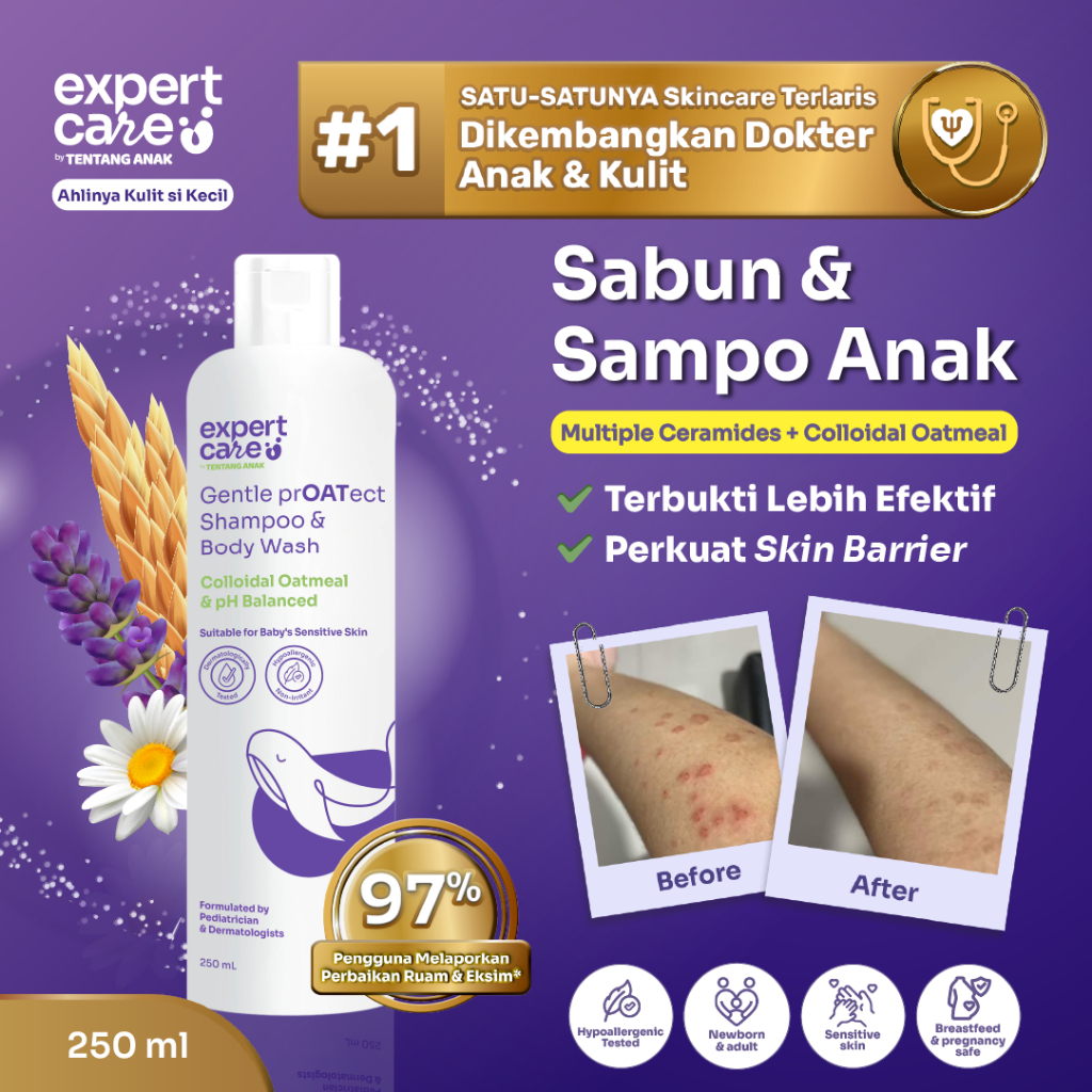 Jual Expert Care 2in1 Shampoo and Body Wash l Sampo dan Sabun Bayi Anak ...