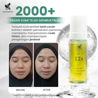 Produk Amiraderm Official | Shopee Indonesia