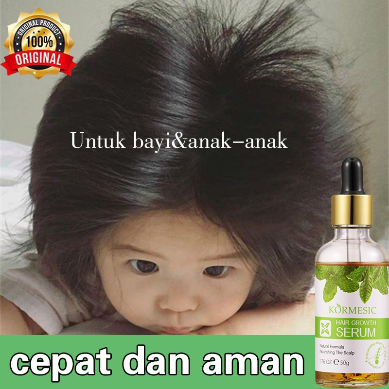 Jual Serum penumbuh rambut Penumbuh rambut bayi dan anak Hair growth ...