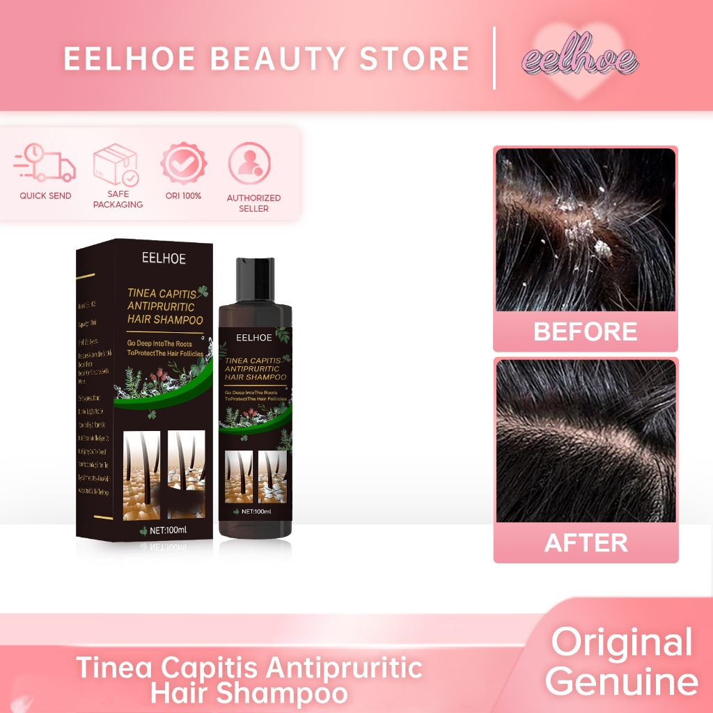 Jual EELHOE Tinea Capitis Antipruritic Hair Shampoo - Cocok untuk ...