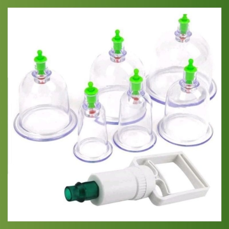 Jual KOP ANGIN / ALAT BEKAM COP ANGIN ISI 6 | Shopee Indonesia