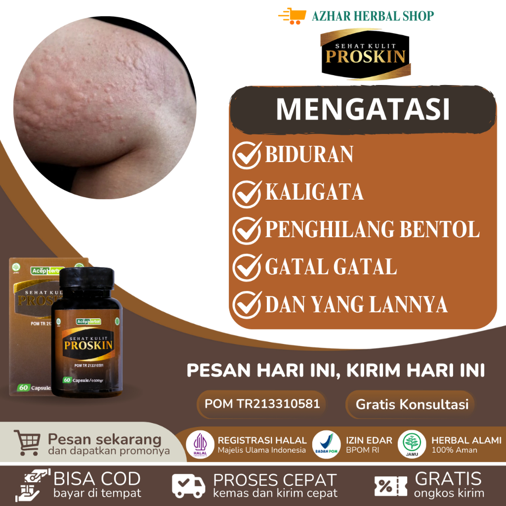Jual Proskin - Obat Gatal Kulit Alergi Dingin Penghilang Bentol Gatel ...