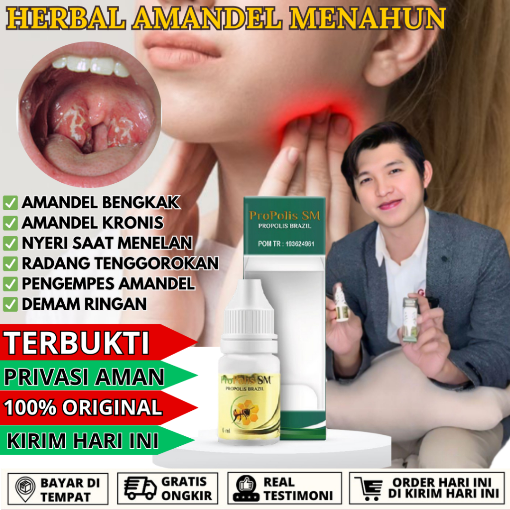 Jual Obat Herbal Amandel Mengempeskan Amandel Bengkak Randang Amandel Amandel Sakit Untuk Anak ...