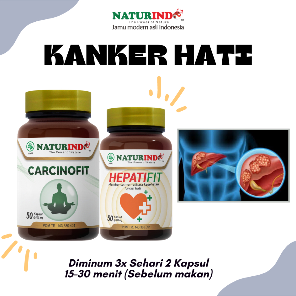 Jual Obat kanker dan tumor paling ampuh untuk anus serviks usus hati ...