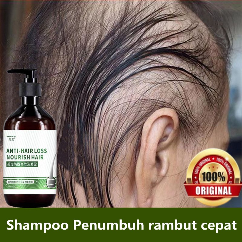 Jual Sampo Penumbuh Rambut Cepat Anak Penumbuh Rambut Rontok Shampoo ...