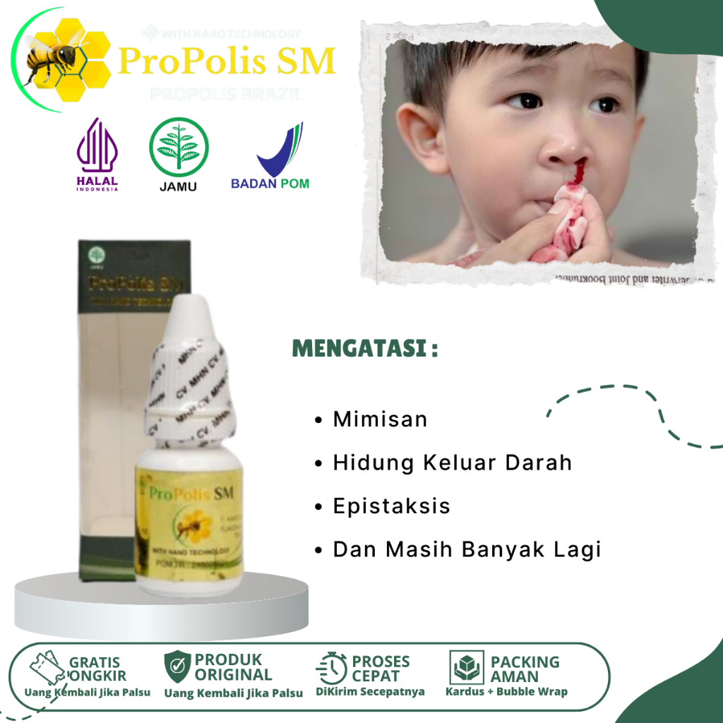 Jual Obat Sering Mimisan, Obat Penghenti Mimisan, Obat Hidung Keluar ...