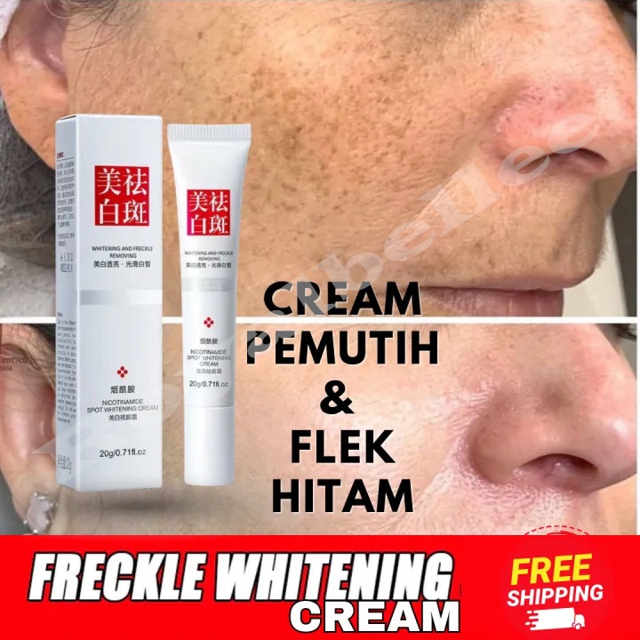 Jual Effective Freckle Cream penghilang flek hitam whitening Krim anti bintik dan pemutih 20g ...