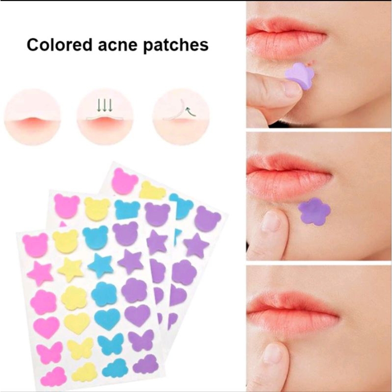 Jual ACNE PATCH STICKER JERAWAT[MIX] | Shopee Indonesia