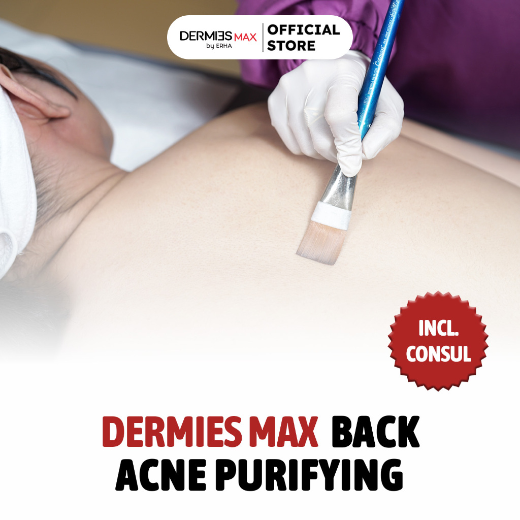 Jual Dermies Max Back Acne Purifying | Shopee Indonesia