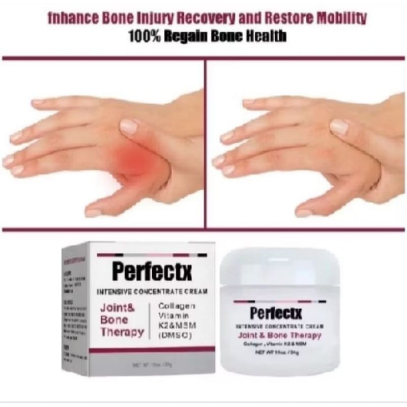 Jual PERFECTX Intensive Concentrate Cream || Joint And Bone Therapy ...