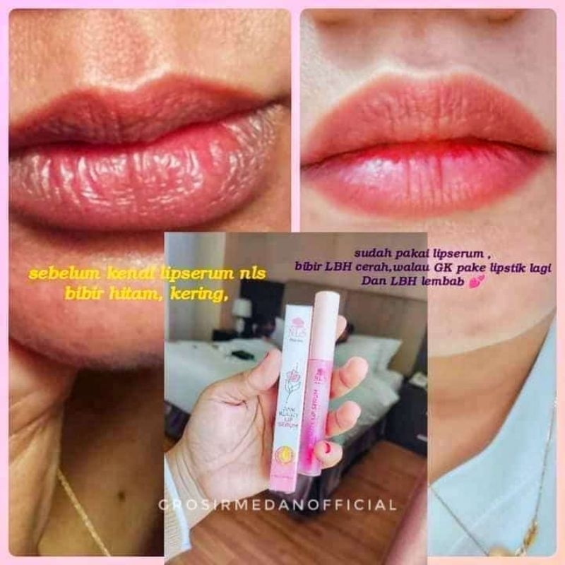 Jual LIPSERUM NLS SKINCARE VIRAL!!! BIBIR SEHAT LEMBAB - MENGEMBALIKAN WARNA PINK ALAMI BIBIR ...
