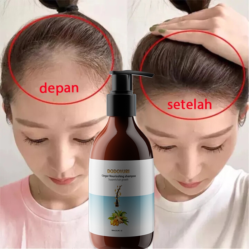 Jual 【BPOM】shampoo rambut rontok shampoo penumbuh rambut cepat shampoo ...