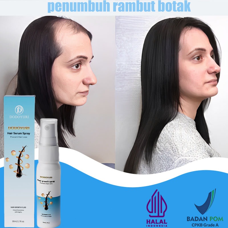 Jual (BPOM)Obat penumbuh rambut penumbuh rambut cepat serum penumbuh ...