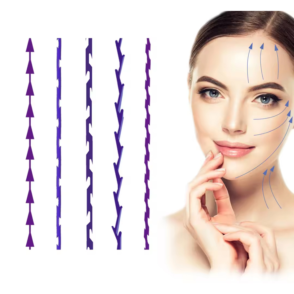 Jual Ella benang wajah PCL&PDO fishbone molding 18g*100mm a pack of 2benang//Retail | Shopee ...