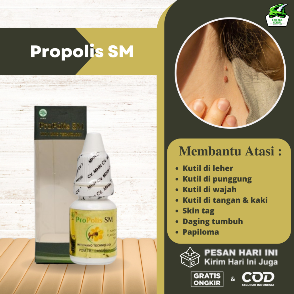 Jual Obat Herbal Perontok Kutil, Di Leher, Punggung, Dada, Wajah ...