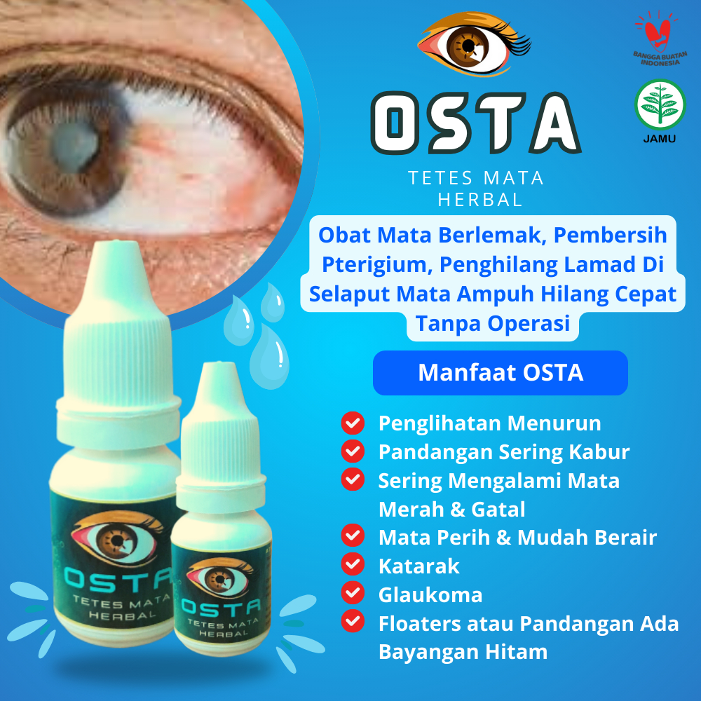 Jual Obat Mata Berlemak, Pembersih Pterigium, Penghilang Lamad Di Selaput Mata Ampuh Hilang ...