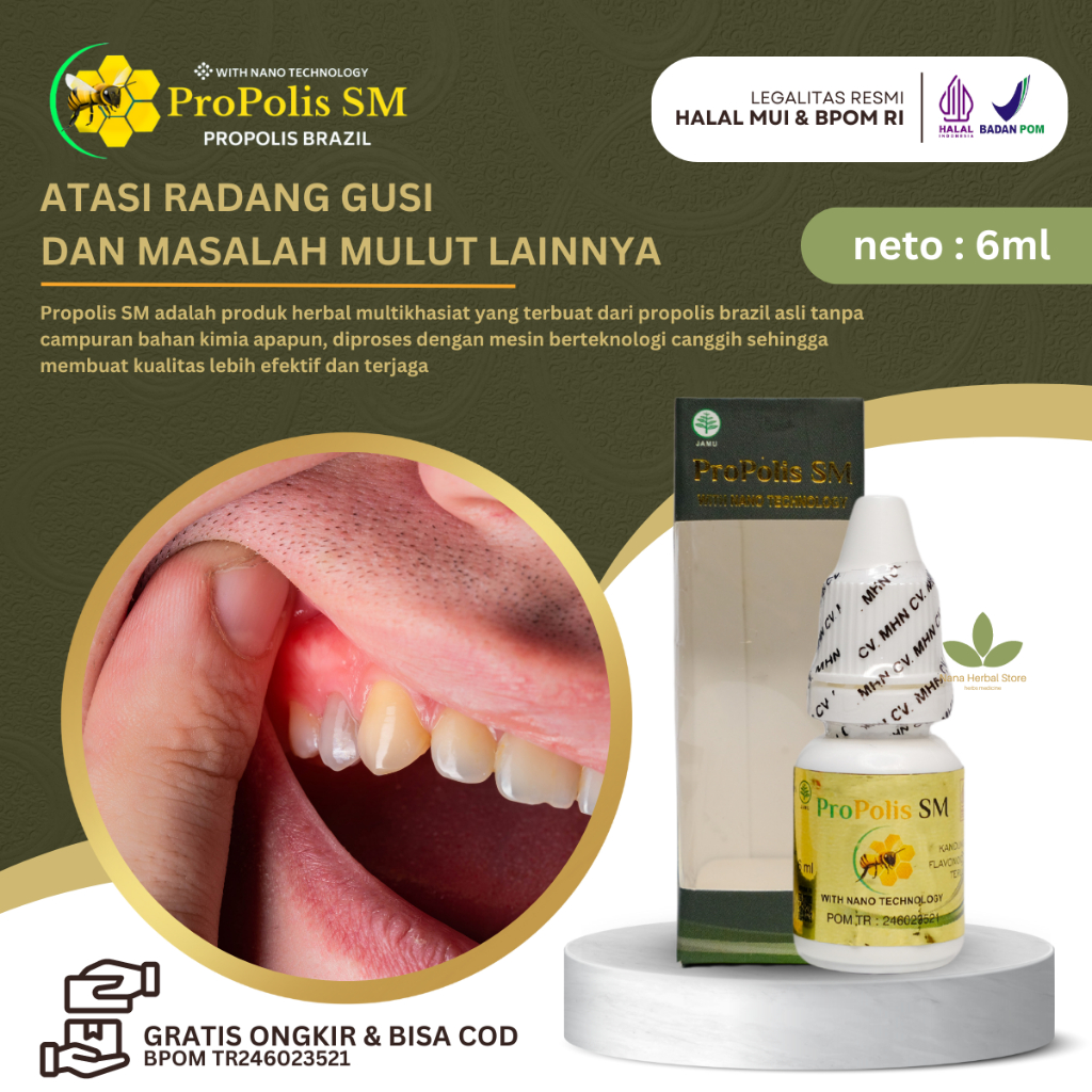 Jual Propolis SM Obat Radang Gusi Bengkak Sakit Berdarah Ngilu Gigi Berlubang Penghilang Plak ...