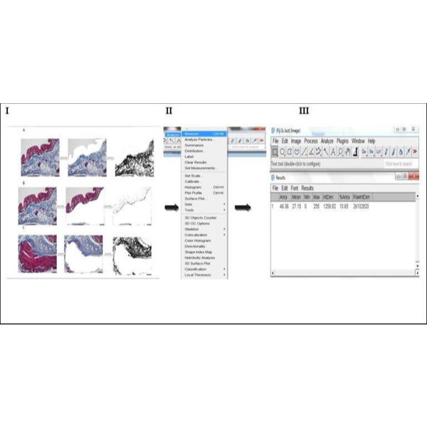 Jual Analisis Kuantitatif Total Serat Kolagen Pewarnaan Masson's Trichrome Menggunakan Software ...
