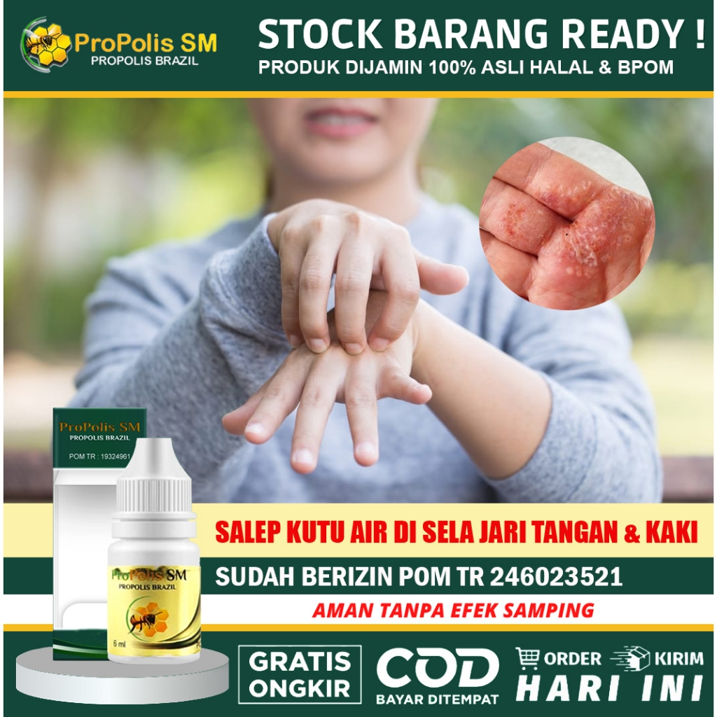 Jual Obat Kutu Air Penghilang Kuman Air Gatal di Jari Sela Sela Jari ...