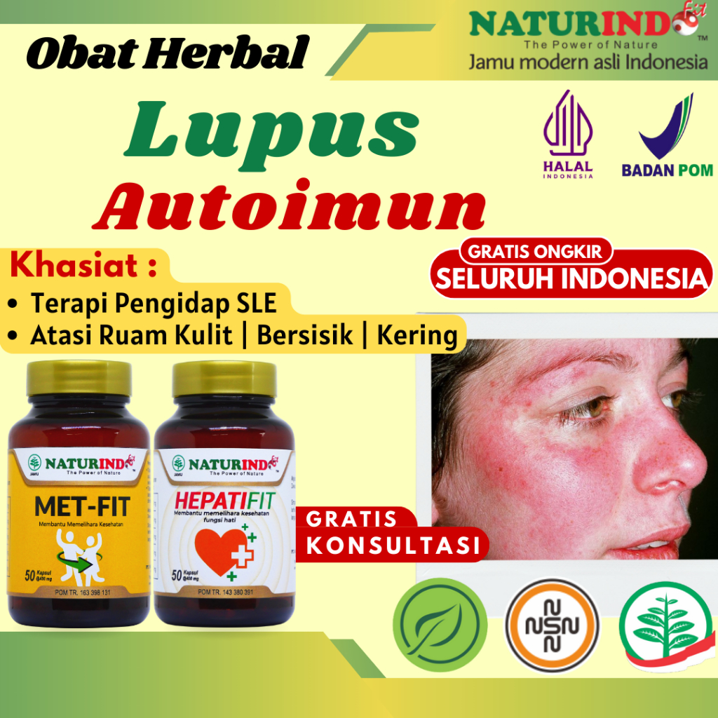 Jual Obat Lupus Autoimun Psoriasis Kulit Ruam Bersisik Eksim Dermatitis ...
