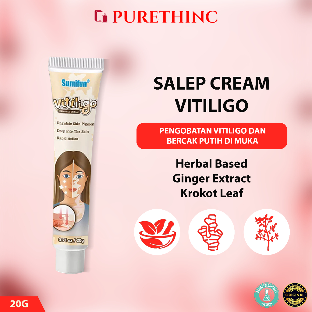 Jual Salep /Obat vitiligo kulit bercak belang putih panu, biang ...