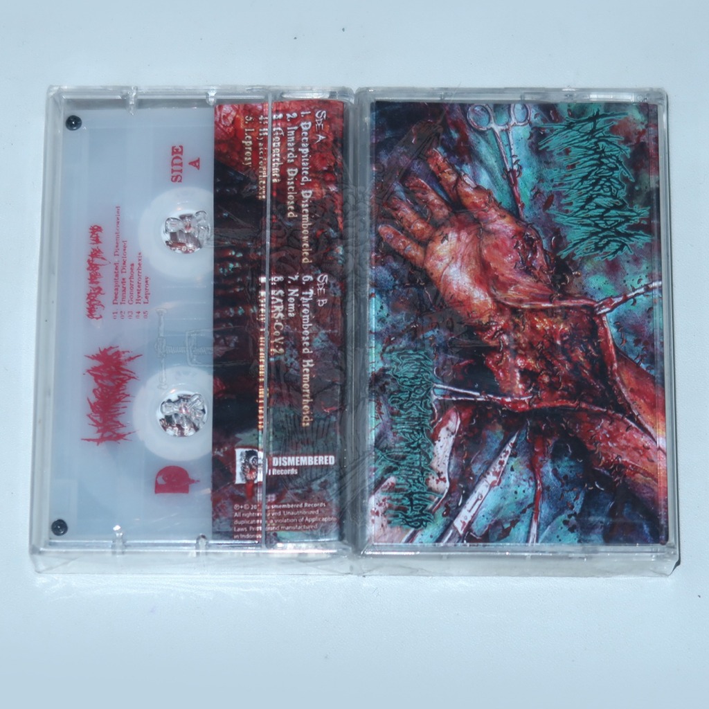 Jual TAPE - HYSTERORRHEXIS - Maggots Infest The Limb | Shopee Indonesia