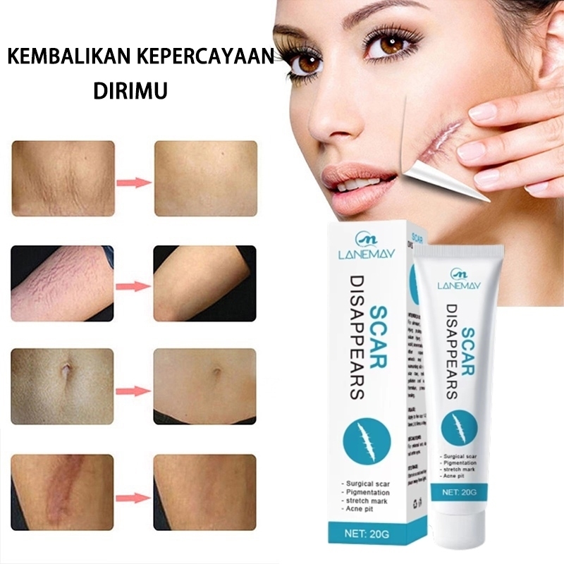 Jual Lanemay Penghilang Bekas Luka 20g Scar Remover Cream Salep ...