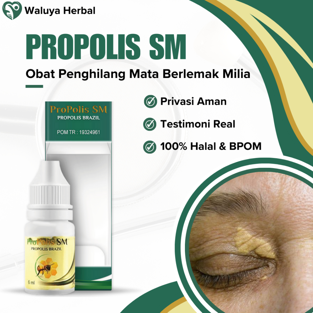Jual Obat Penghilang Gumpalan Lemak di Kelopak Mata Xanthelasma Plak ...