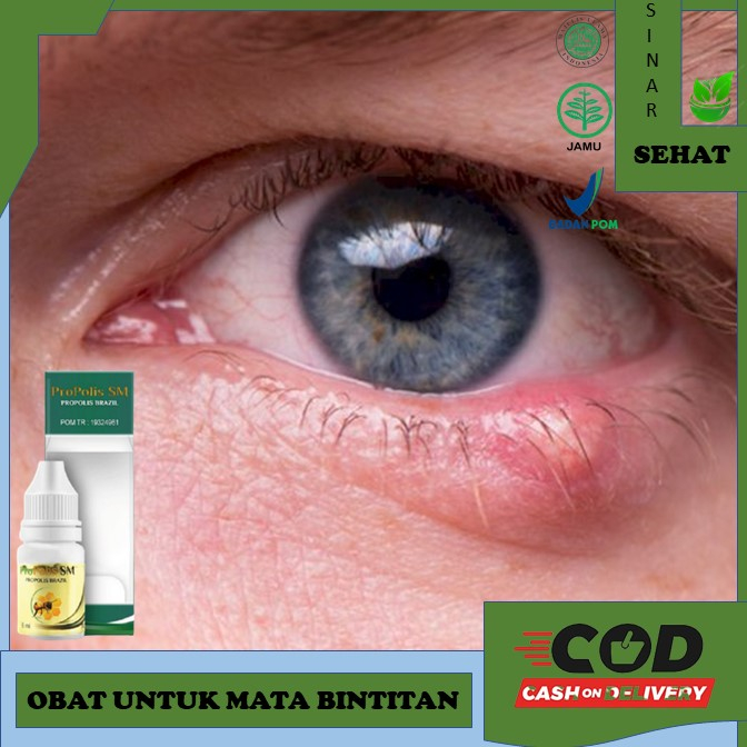 Jual obat mata bintitan Obat Mata Bintitan Obat Mata Bintitan, Benjolan ...