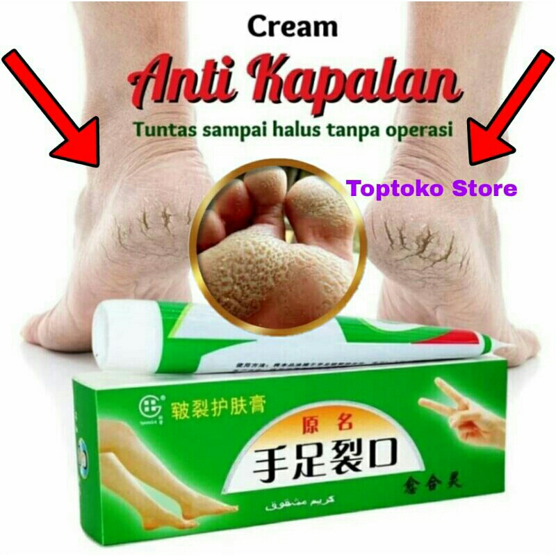 Jual Obat Salep Perawatan Tumit Tangan Kering Tumit pecah Rayapan ...