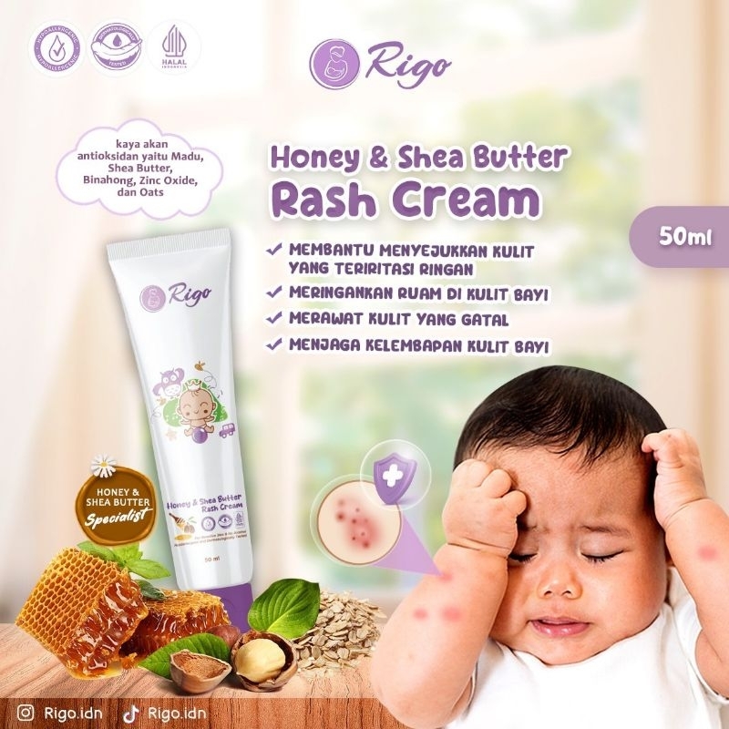 Jual Rigo Honey Shea Butter Rash Cream 50ml | Shopee Indonesia