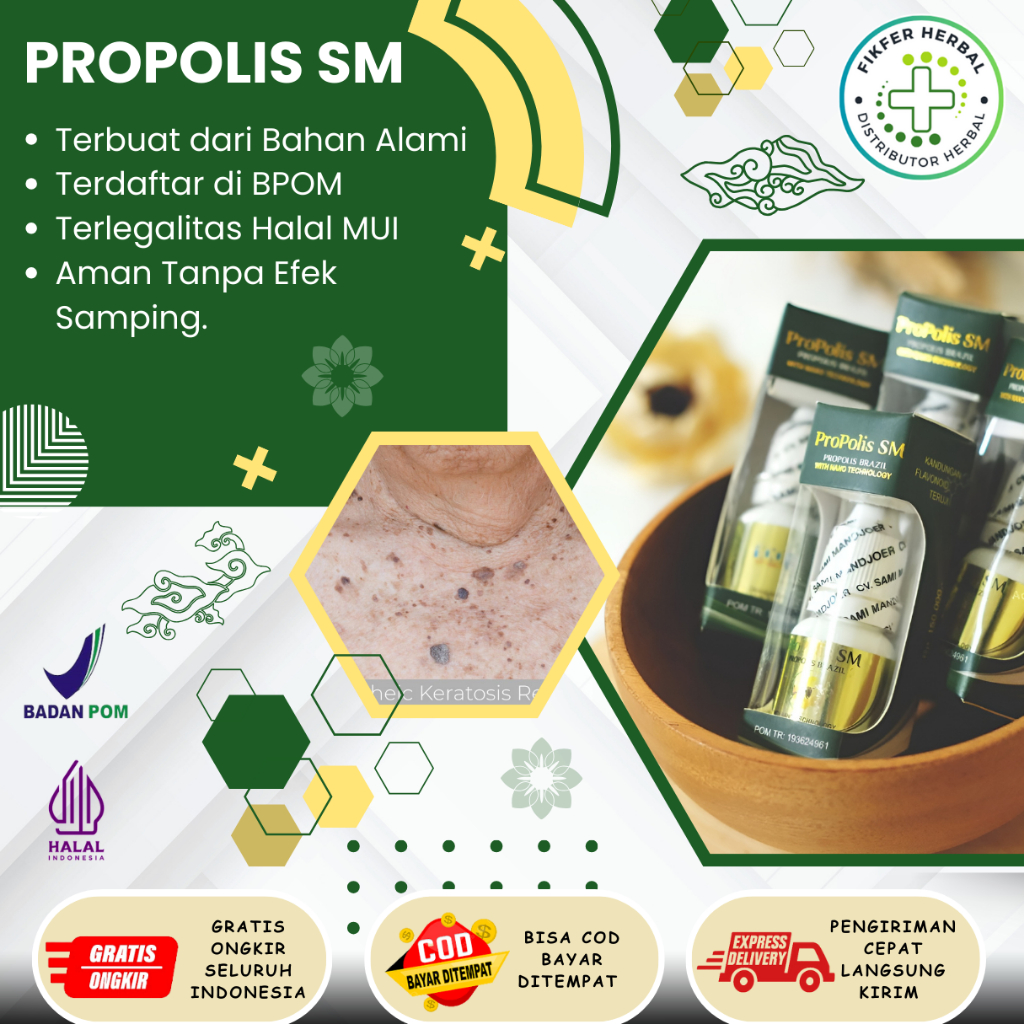 Jual Obat Keratosis seboroik, Keratosis Pilaris, Benjolan Kutil Kecil ...