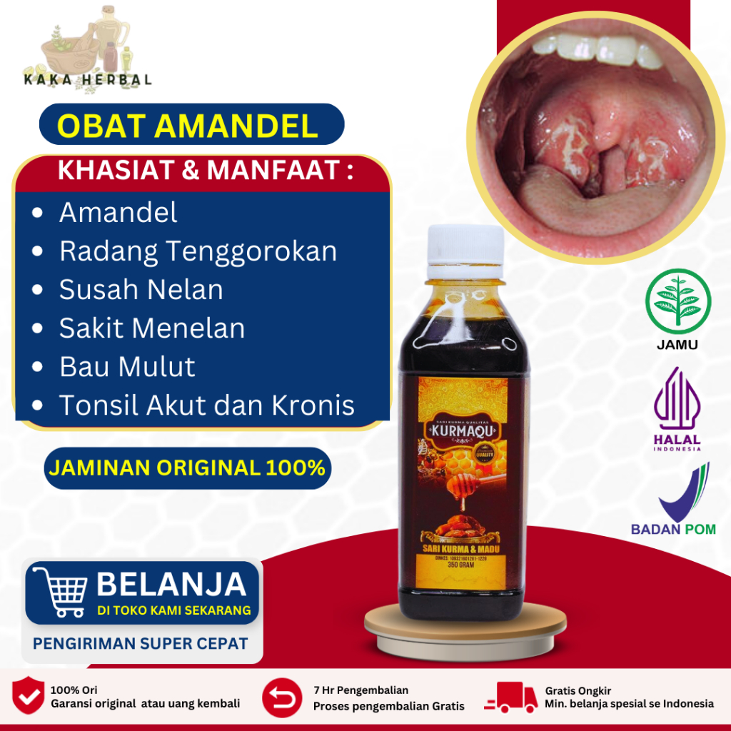 Jual Kaka Herbal - Obat Khusus Amandel Anak dan Dewasa, Susah Nelan, Sakit Menelan, Radang ...