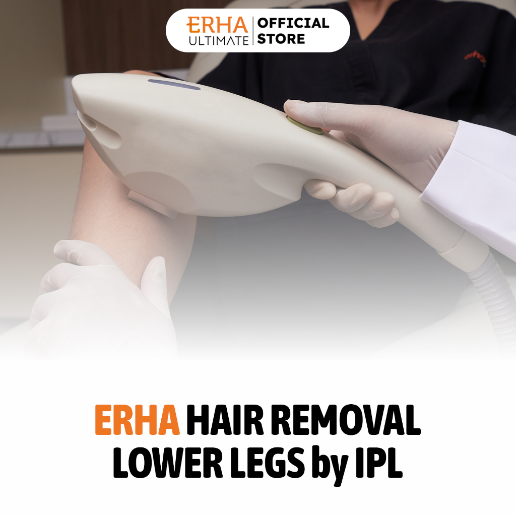 Jual ERHA Hair Removal Lower Legs by IPL | Shopee Indonesia