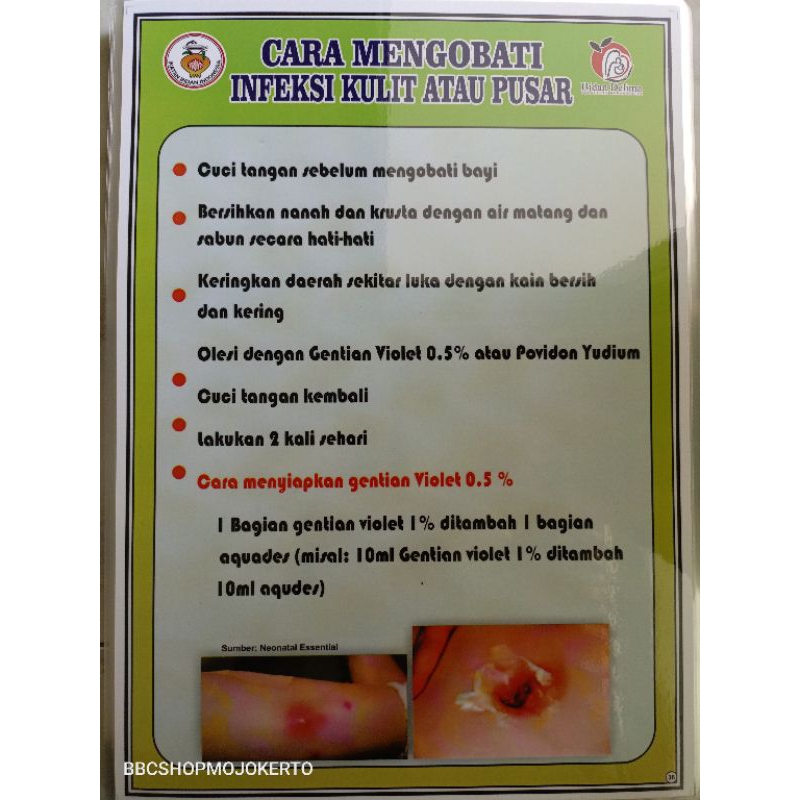Jual (38) POSTER KESEHATAN CARA MENGOBATI INFEKSI KULIT ATAU PUSAR ...