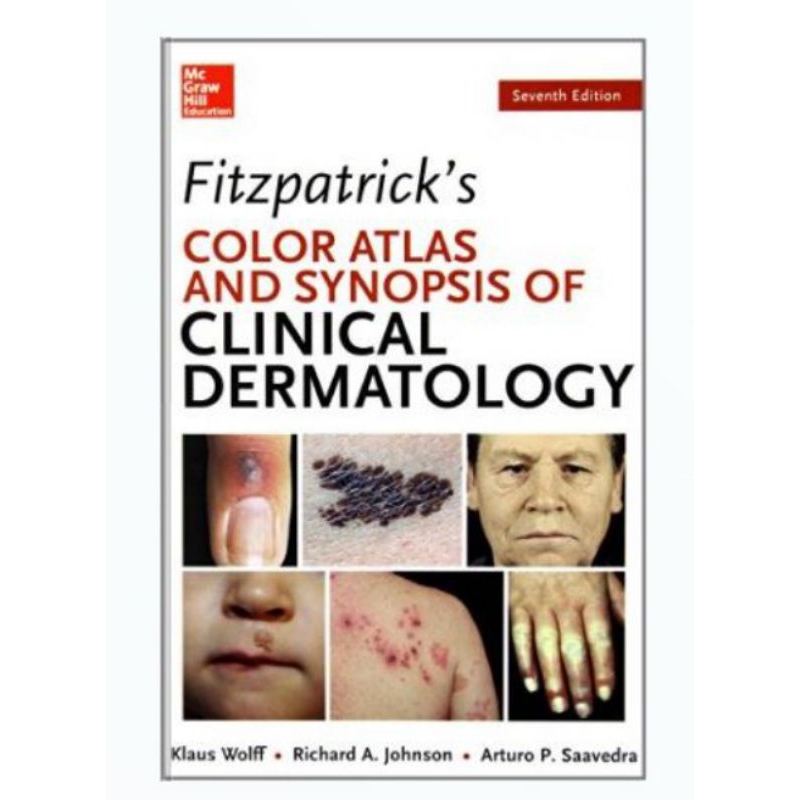 Jual Fitzpatrick's Color Atlas and Synopsis of Clinical Dermatology ...