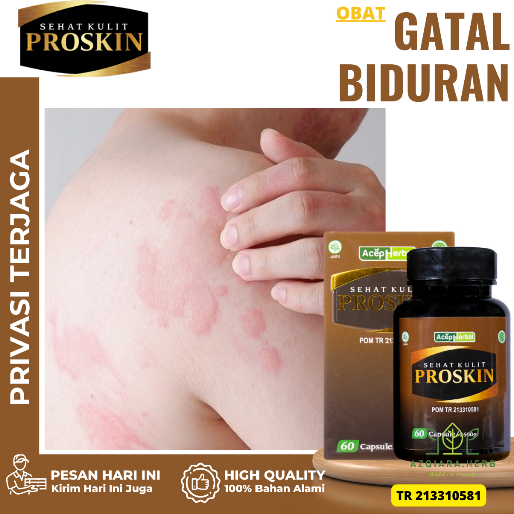 Jual Obat Biduran, Obat Infeksi Jamur Kulit Gatal, Obat Psoriasis Kulit ...