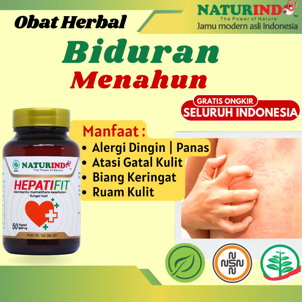 Jual Obat Biduran Alergi Dingin Dan Panas Gatal Biang Keringat Ruam ...