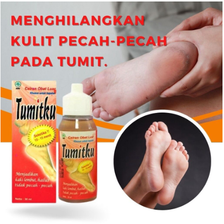Jual tumitku anti kaki pecah dan kapal Obat Kapalan dan Kaki Pecah ...