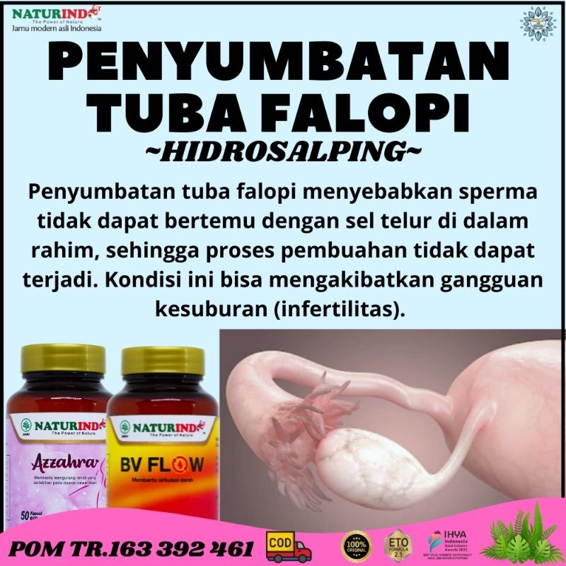 Jual Obat Tuba Falopi Tersumbat Obat Herbal Hidrosalping Penyumbatan ...