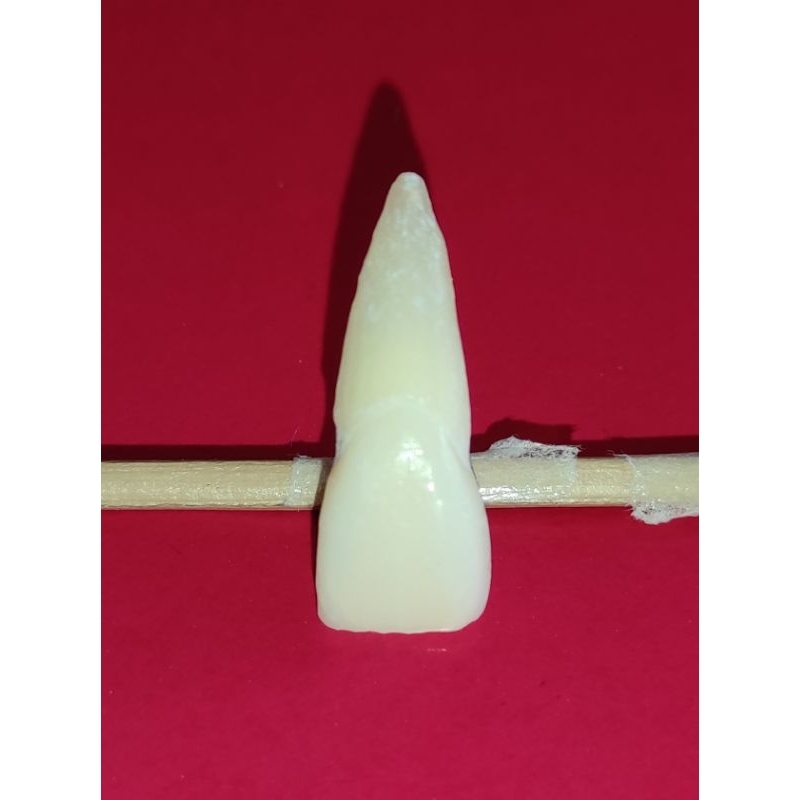 Jual Gigi Insisif Sentral Kiri Rahang Atas (Gigi 21) - Gigi Asli - Gigi ...