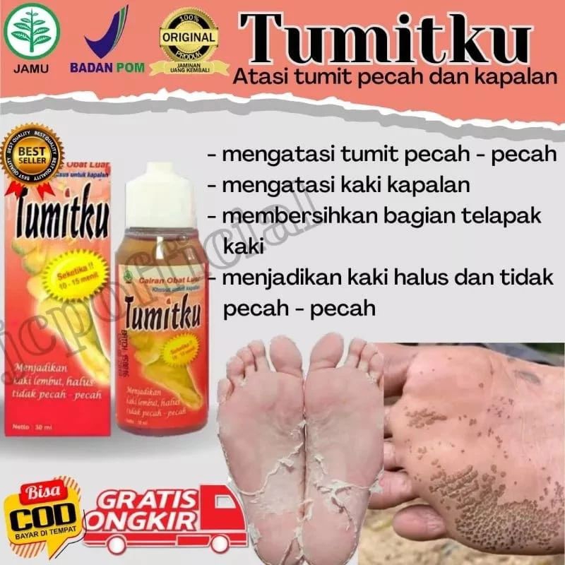 Jual TUMITKU OBAT KAKI KAPALAN PECAH PECAH DAN KERING 30ML | Shopee ...