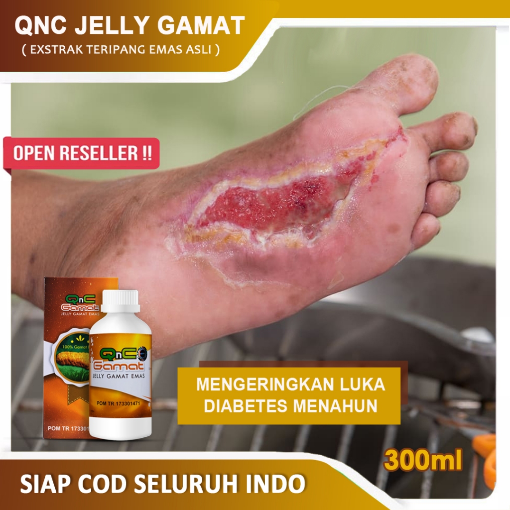 Jual Obat Luka Diabetes Agar Cepat Kering Luka Bernanah Luka Diabates ...