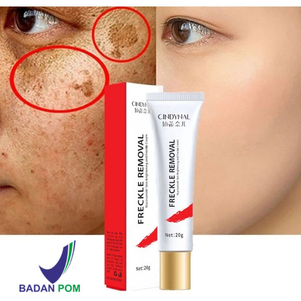 Jual CINDYNAL NIACINAMIDE Skin Cream Krim Penghilang Flek Hitam Membandel Di Wajah | Shopee ...