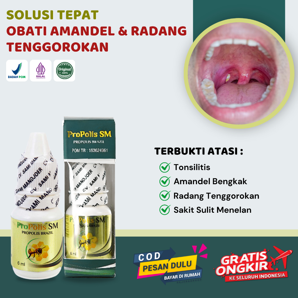 Jual Obat Amandel Dan Radang Tenggorokan Tonsilitis Sakit Sulit Menelan Anak & Dewasa Herbal ...