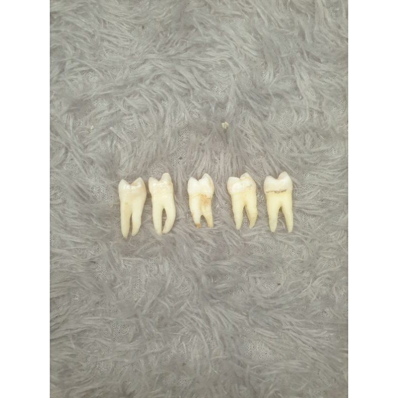 Jual gigi praktikum PREMOLAR ATAS BAWAH ENDO | Shopee Indonesia