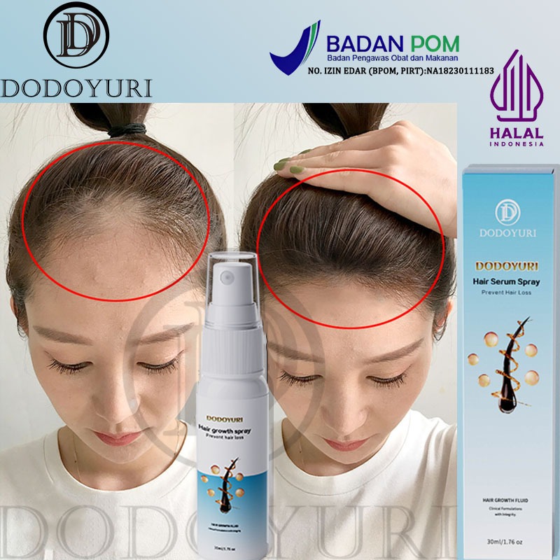 Jual [BPOM] Penumbuh rambut cepat obat penumbuh rambut serum penumbuh ...