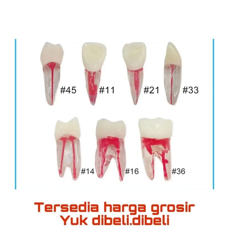 Jual Dental model gigi endodontik saluran akar / tooth model endo ...