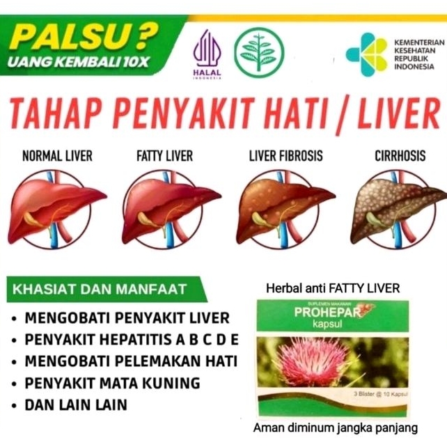 Jual PROHEPAR PER Box isi 30 untuk Fatty Liver kesehatan hati | Shopee ...